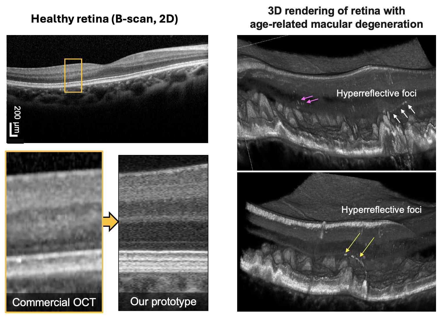 Research - Translational Biophotonics Laboratory