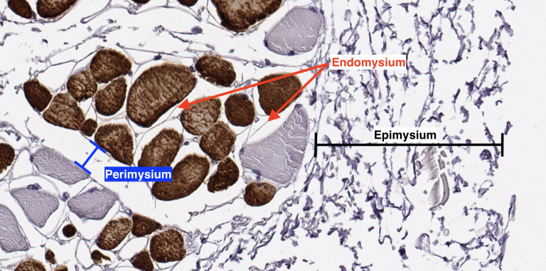 Cartilage/Bone/Muscle Histology Notes – Medical Histology – Jacobs ...
