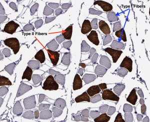 Cartilage/Bone/Muscle Histology Notes – Medical Histology – Jacobs ...