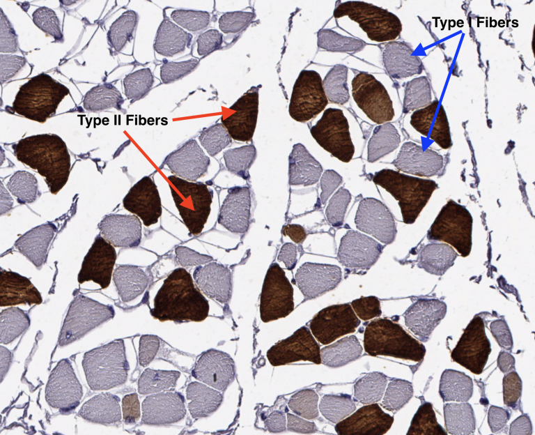 Cartilage/Bone/Muscle Histology Notes – Medical Histology – Jacobs ...