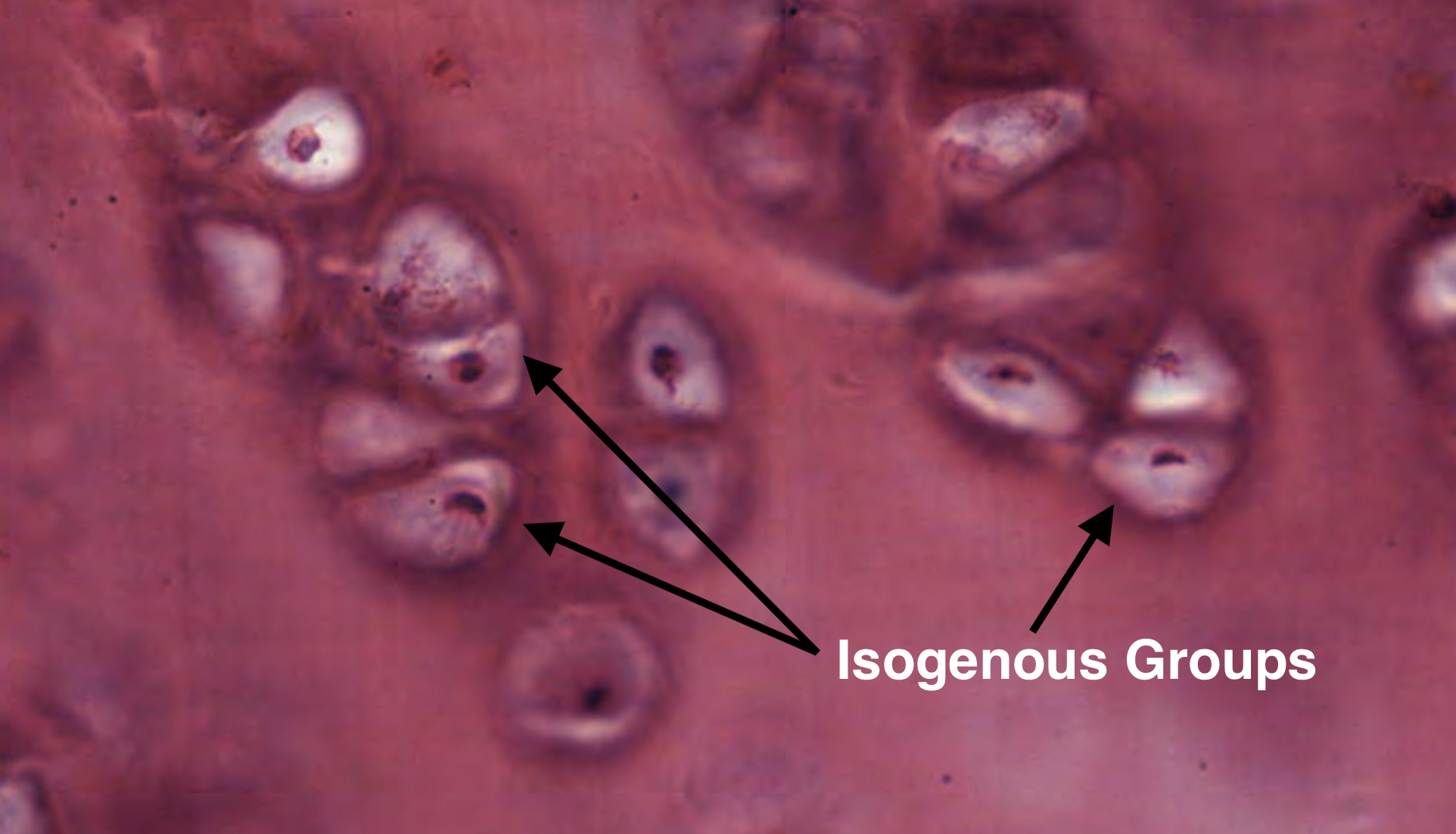 Cartilage/Bone/Muscle Histology Notes – Medical Histology – Jacobs ...