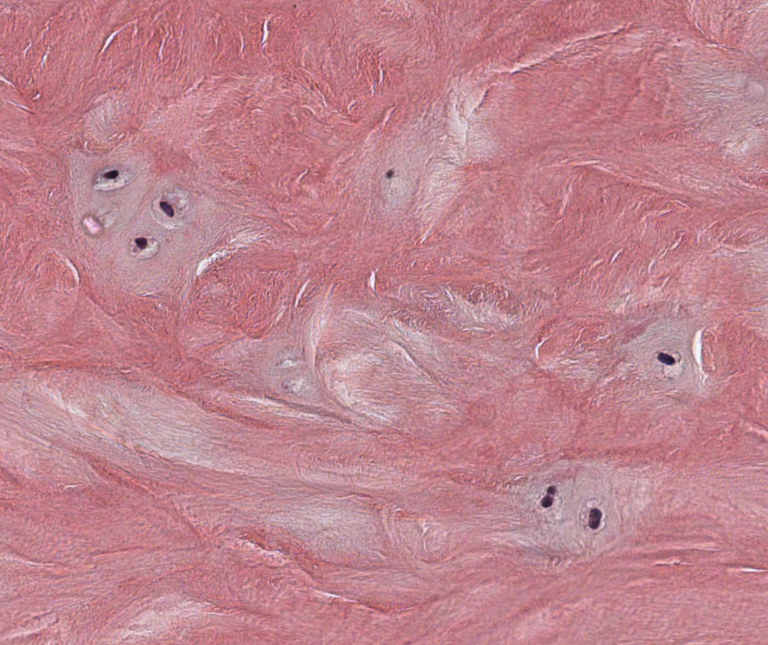 Cartilage/Bone/Muscle Histology Notes – Medical Histology – Jacobs ...