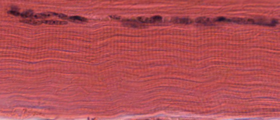 Cartilage/Bone/Muscle Histology Notes – Medical Histology – Jacobs ...