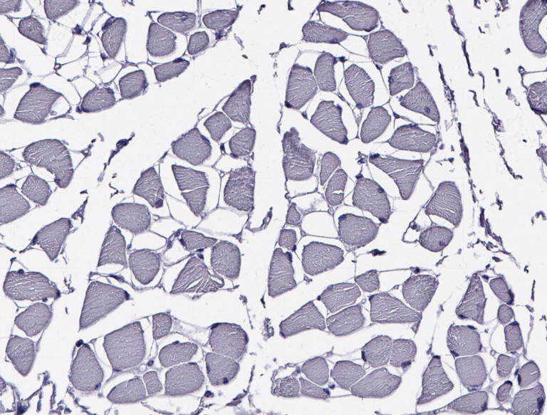Cartilage/Bone/Muscle Histology Notes – Medical Histology – Jacobs ...